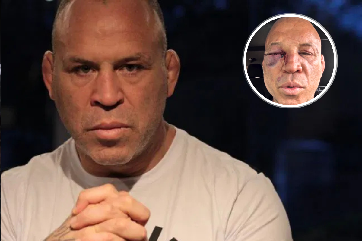 “I Have a Lot of Headaches”: Wanderlei Silva Rushes for Tests After ...